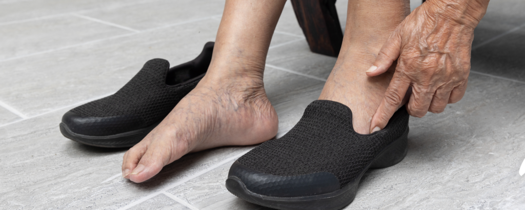 At Home Foot Care Nurse Can Help for Better Foot Health